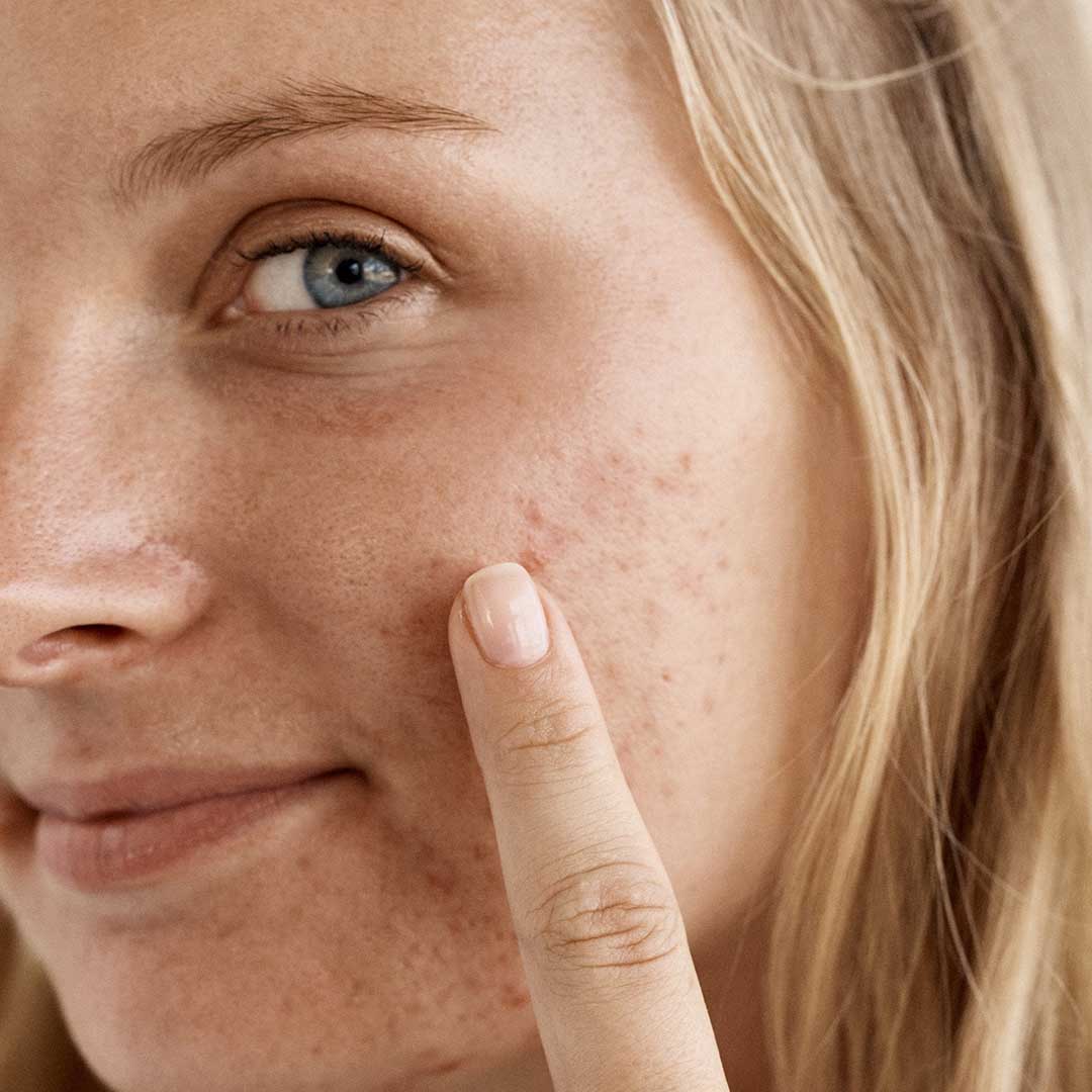 Dermalogica | Tienda oficial | Cuidado de la piel a nivel de instituto ...